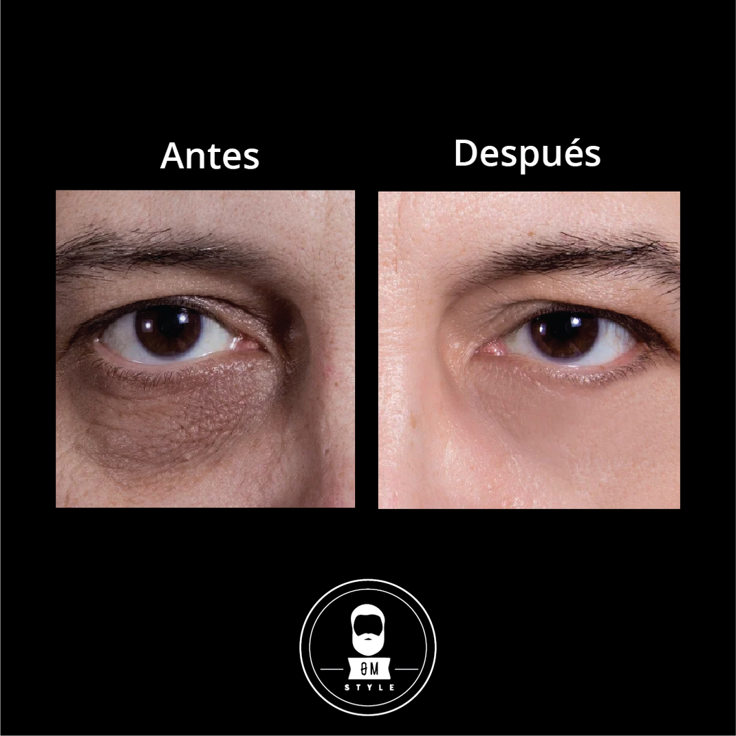 Roll On Anti-Ojeras | Om Style México – OM Style Mexico